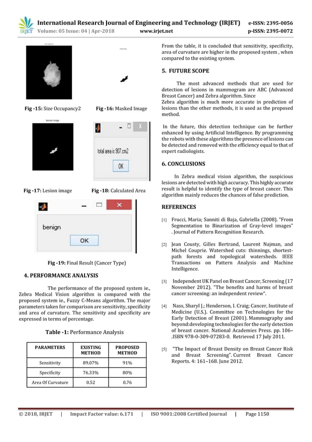 IRJET- Detection of Suspicious Lesions in Mammogram using Zebra Medical Vision Algorithm | PDF ...