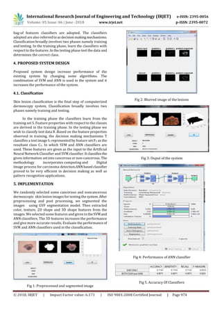 IRJET-Skin Lesion Classification using 3D Reconstruction | PDF | 3-D Graphics | Computer ...