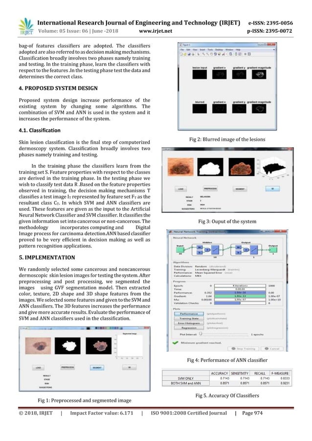 IRJET-Skin Lesion Classification using 3D Reconstruction | PDF | 3-D Graphics | Computer ...