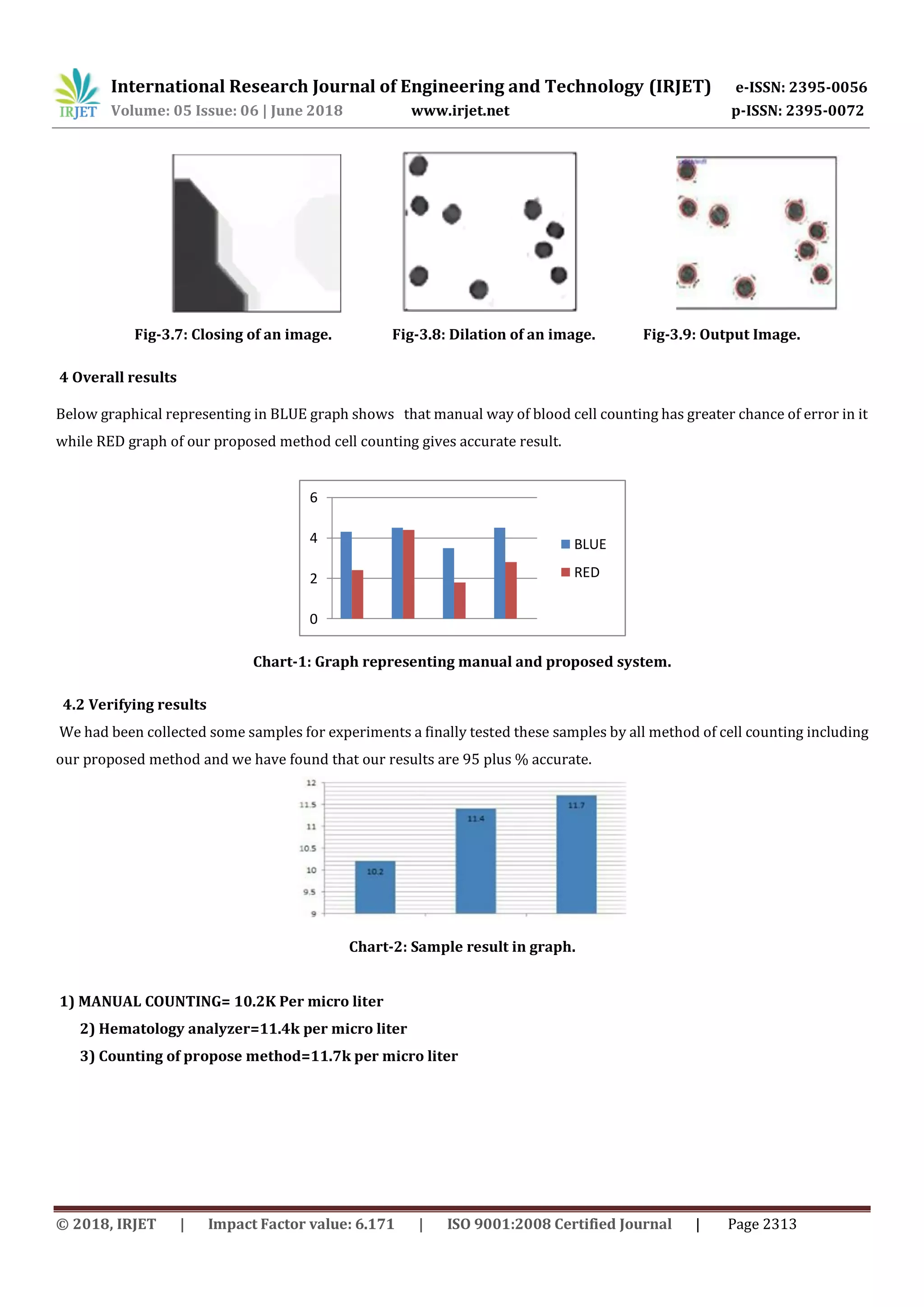 Irjet Automatic Rbc And Wbc Counting Using Watershed Segmentation