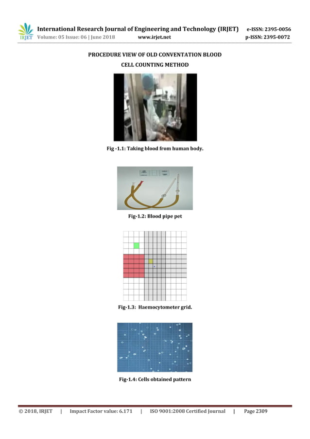 Irjet Automatic Rbc And Wbc Counting Using Watershed Segmentation