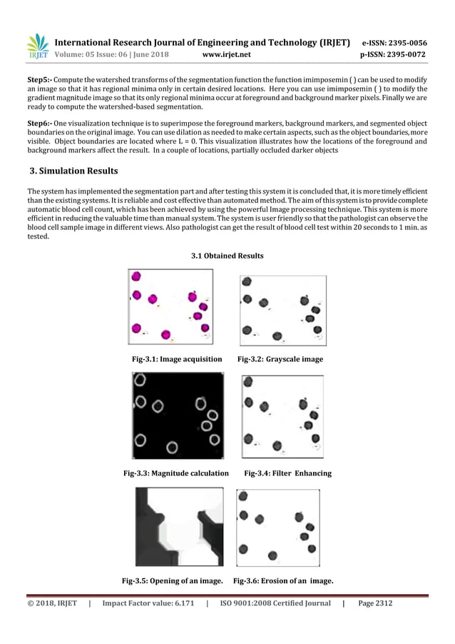 IRJET-Automatic RBC And WBC Counting using Watershed Segmentation Algorithm | PDF
