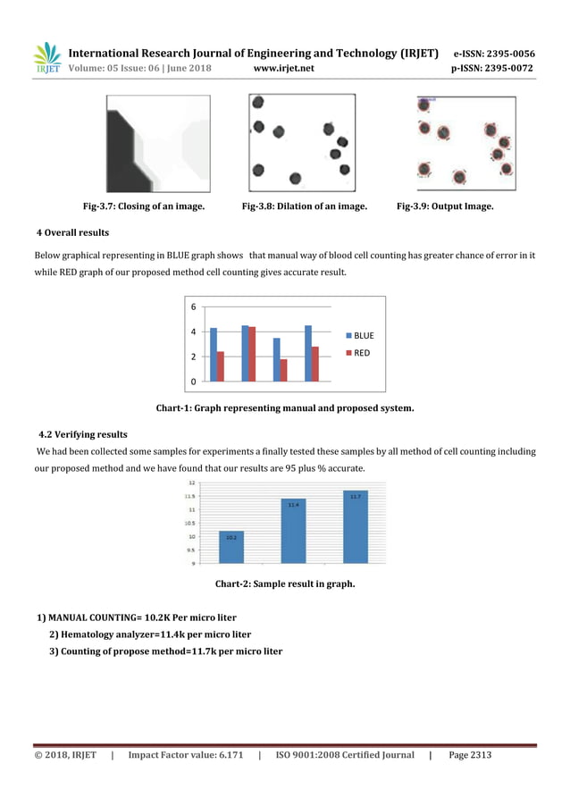 Irjet Automatic Rbc And Wbc Counting Using Watershed Segmentation