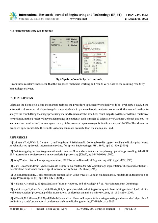 IRJET-Automatic RBC And WBC Counting using Watershed Segmentation Algorithm | PDF