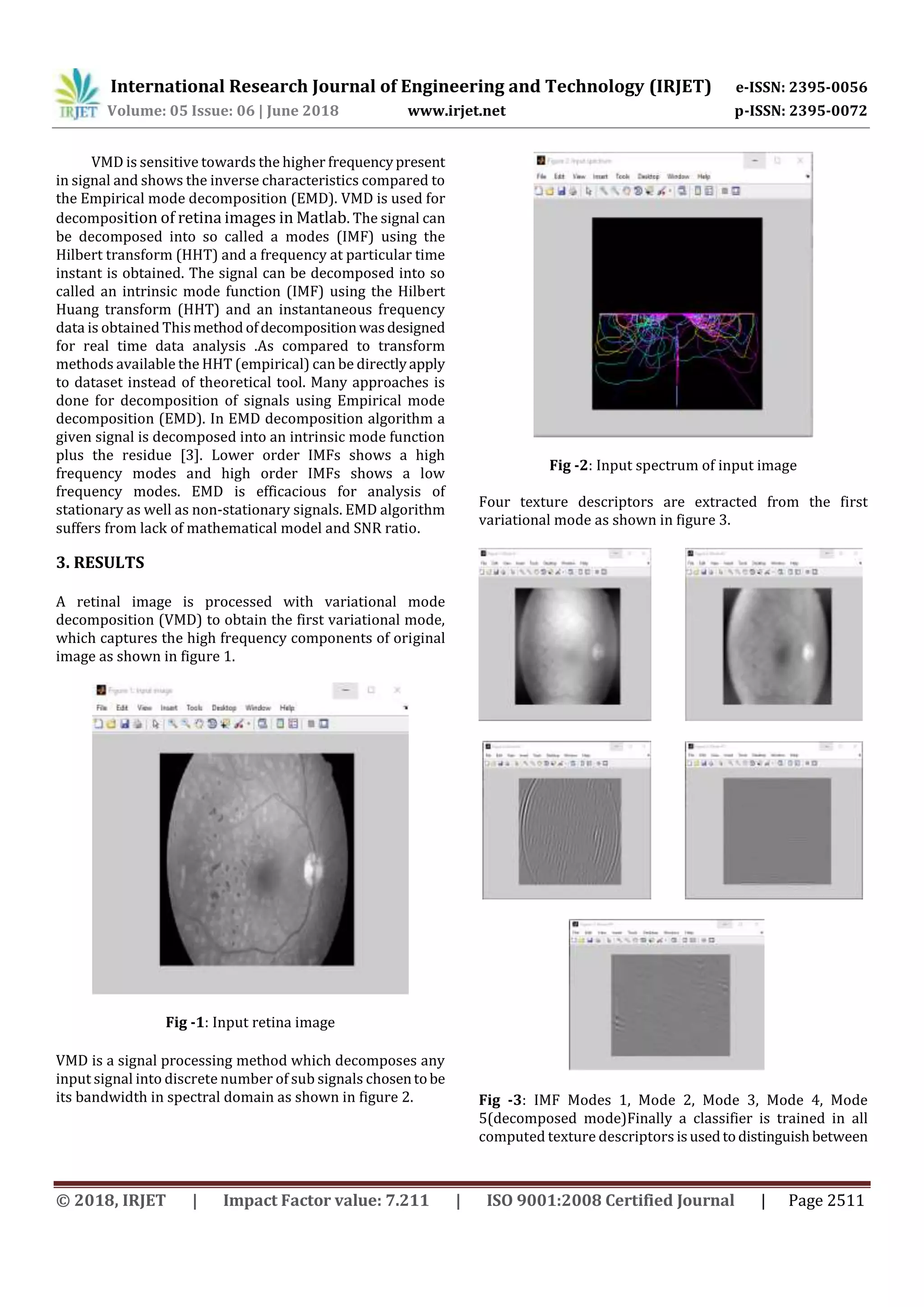 IRJET-Retina Image Decomposition using Variational Mode Decomposition | PDF