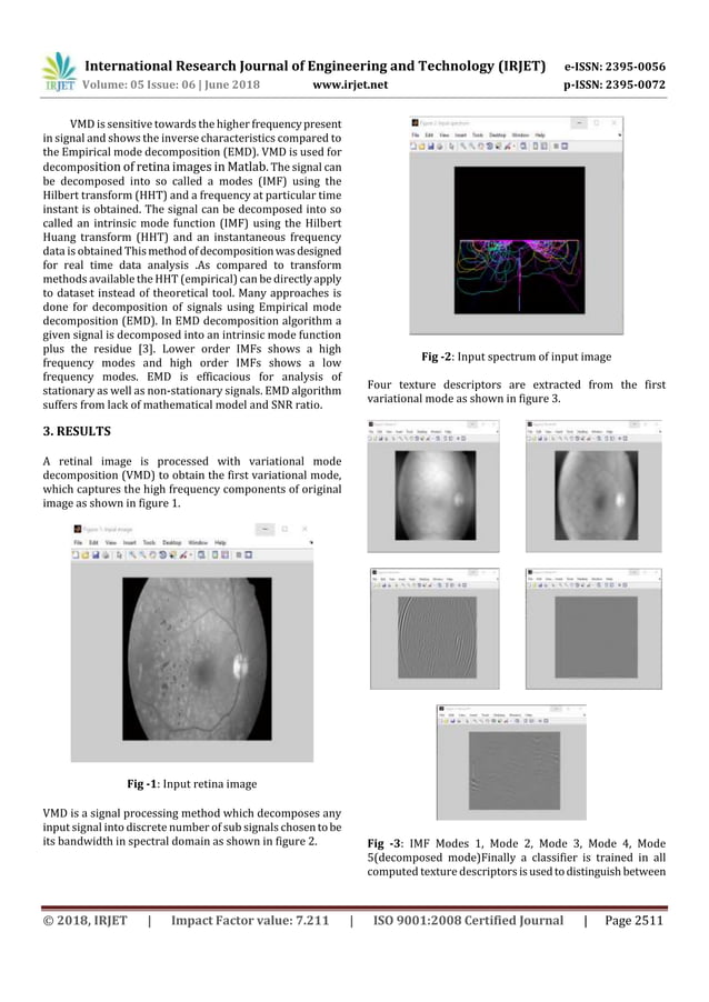 IRJET-Retina Image Decomposition using Variational Mode Decomposition | PDF