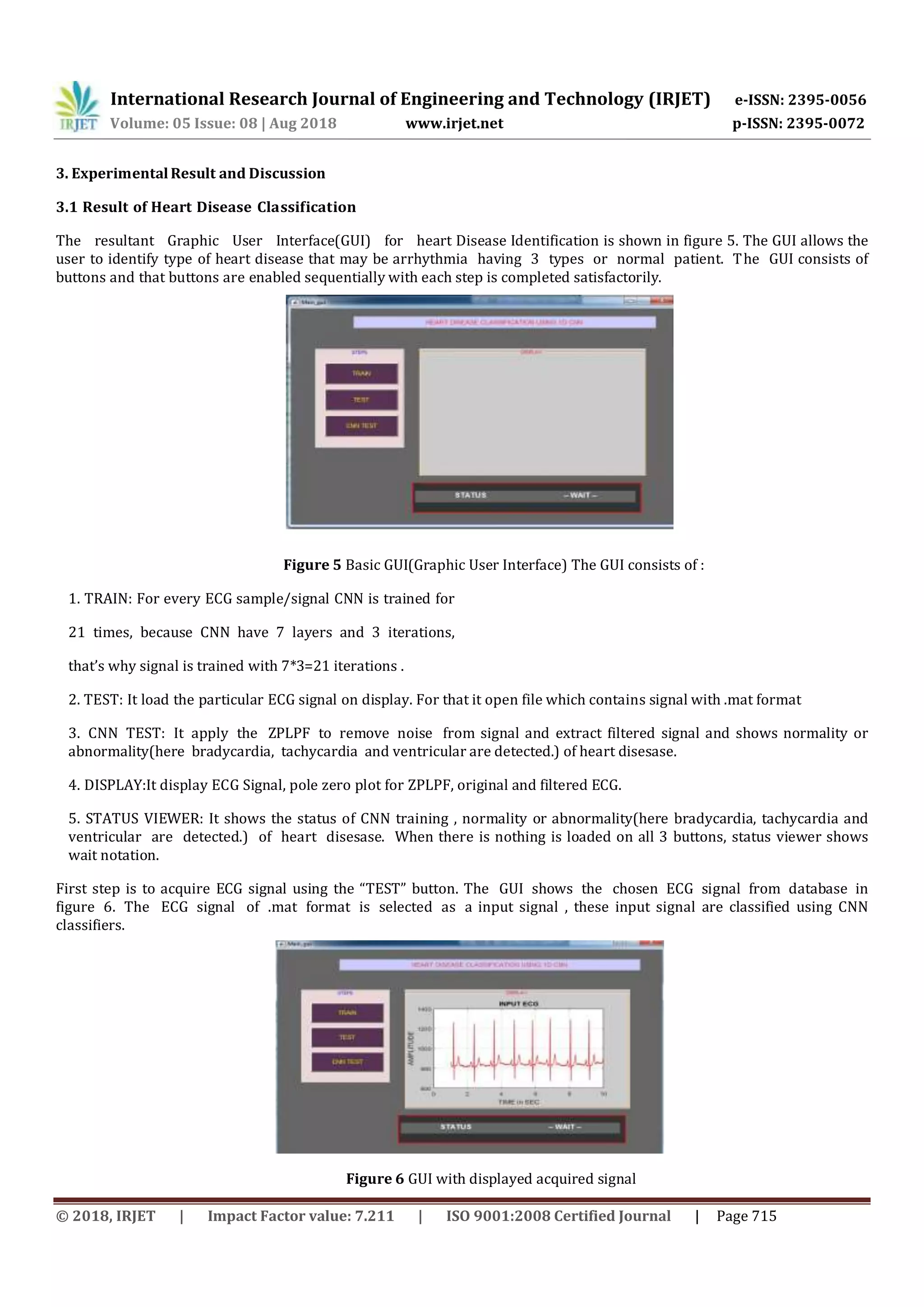 IRJET- Arrhythmia Detection using One Dimensional Convolutional Neural Network | PDF