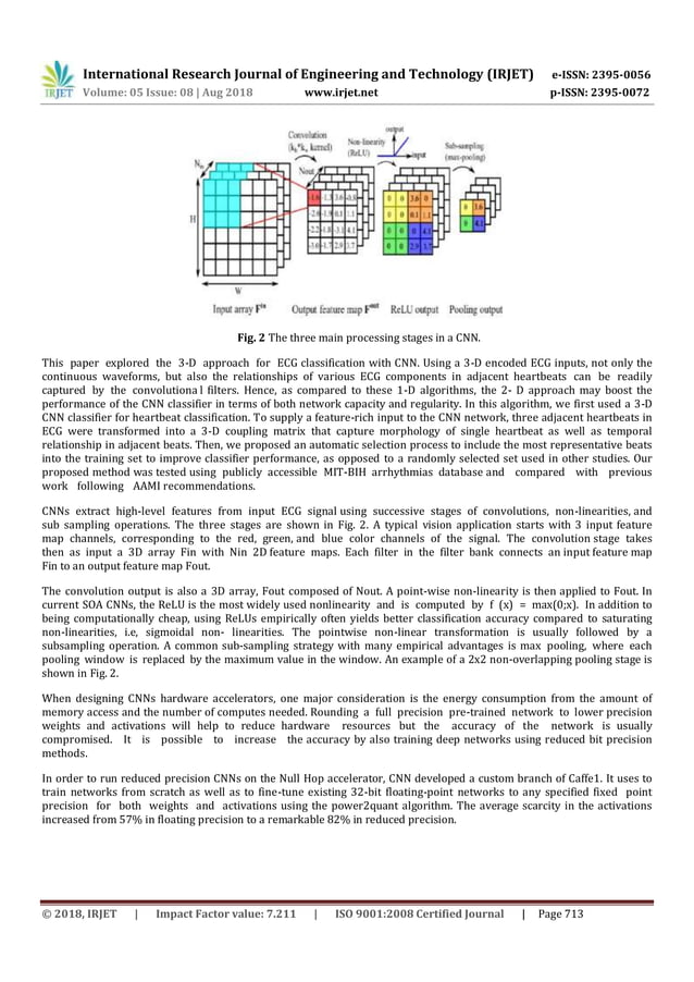 IRJET- Arrhythmia Detection using One Dimensional Convolutional Neural Network | PDF