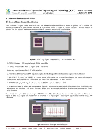 IRJET- Arrhythmia Detection using One Dimensional Convolutional Neural Network | PDF