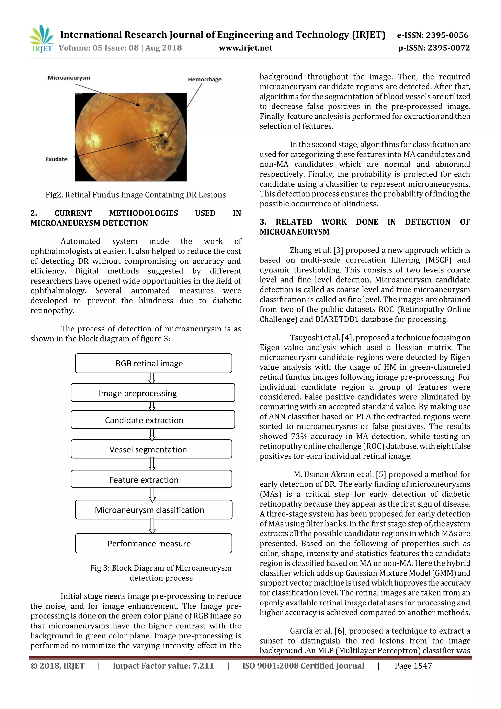 IRJET- Detection of Microaneurysm in Diabetic Retinopathy: A Review | PDF
