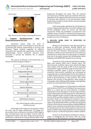 IRJET- Detection of Microaneurysm in Diabetic Retinopathy: A Review | PDF