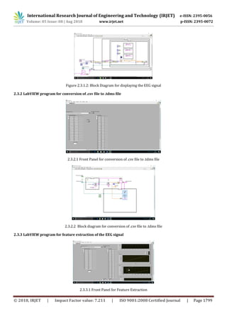 IRJET- Analysis of Electroencephalogram (EEG) Signals | PDF