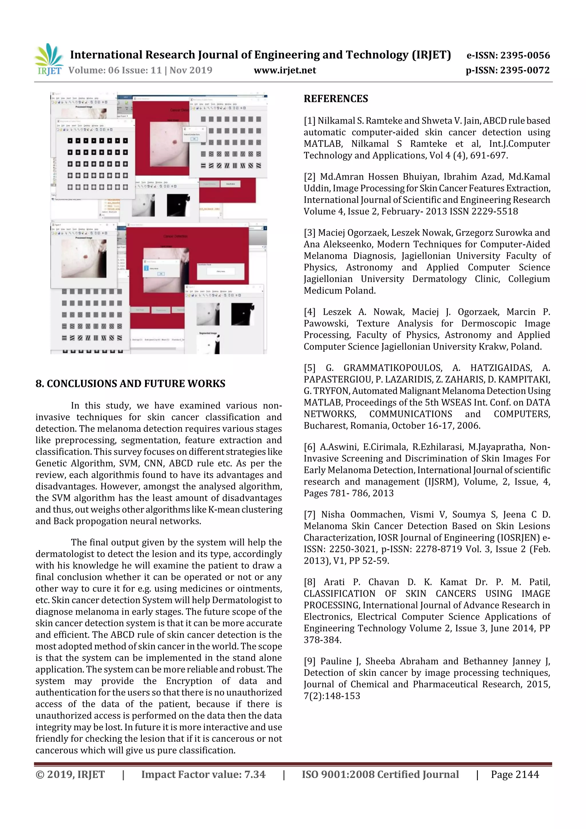 IRJET- Skin Cancer Detection using Digital Image Processing | PDF