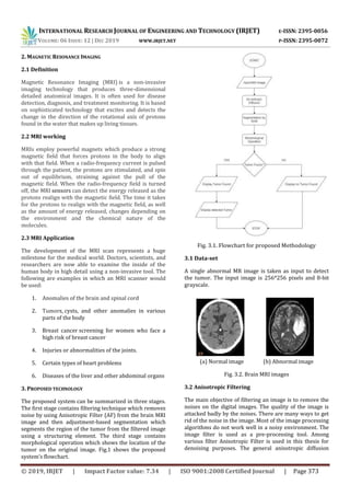 IRJET- Brain Tumor Detection using Image Processing and MATLAB Application | PDF