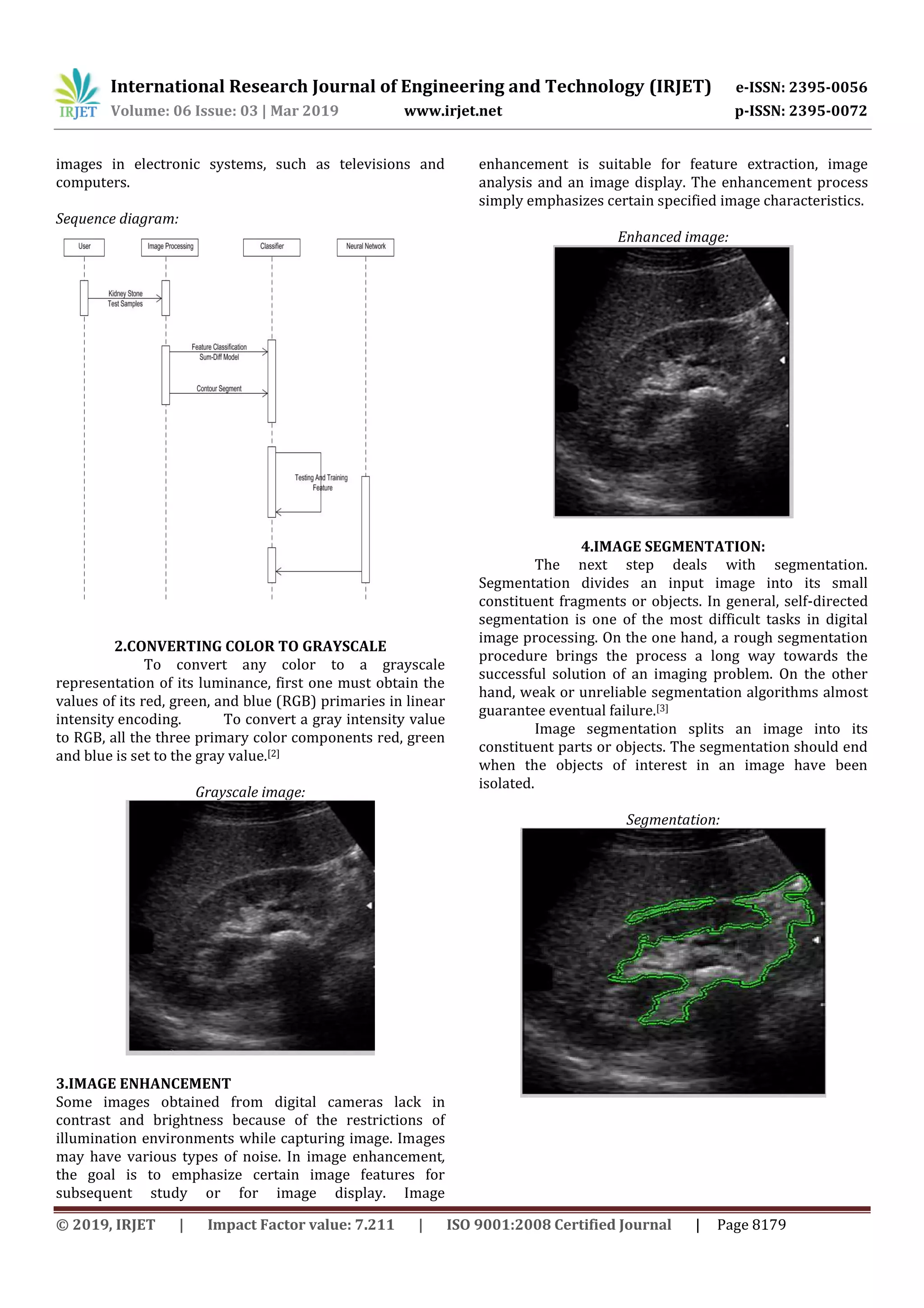 IRJET- Kidney Stone Classification using Deep Neural Networks and Facilitating Diagnosis using ...