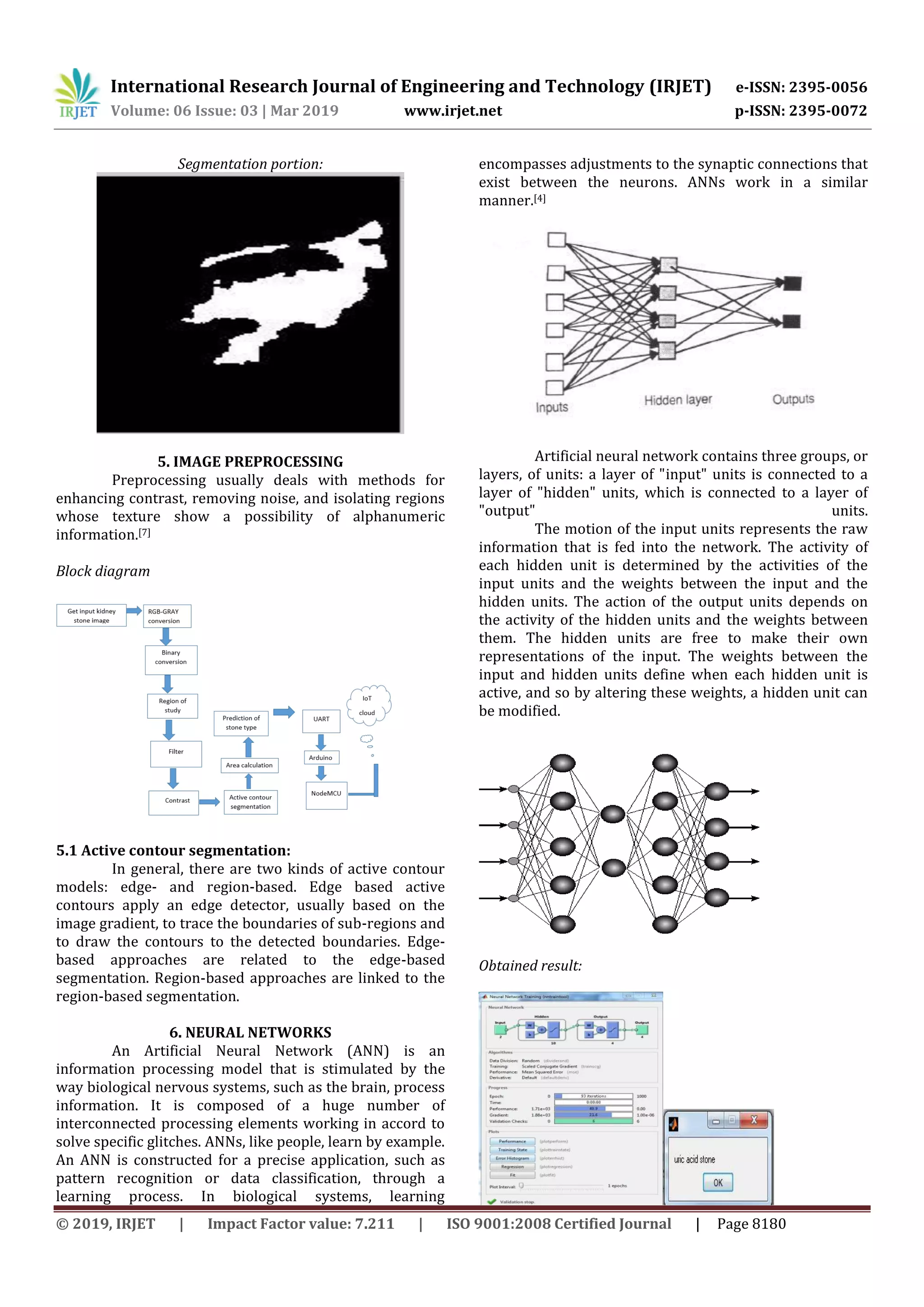 IRJET- Kidney Stone Classification using Deep Neural Networks and Facilitating Diagnosis using ...