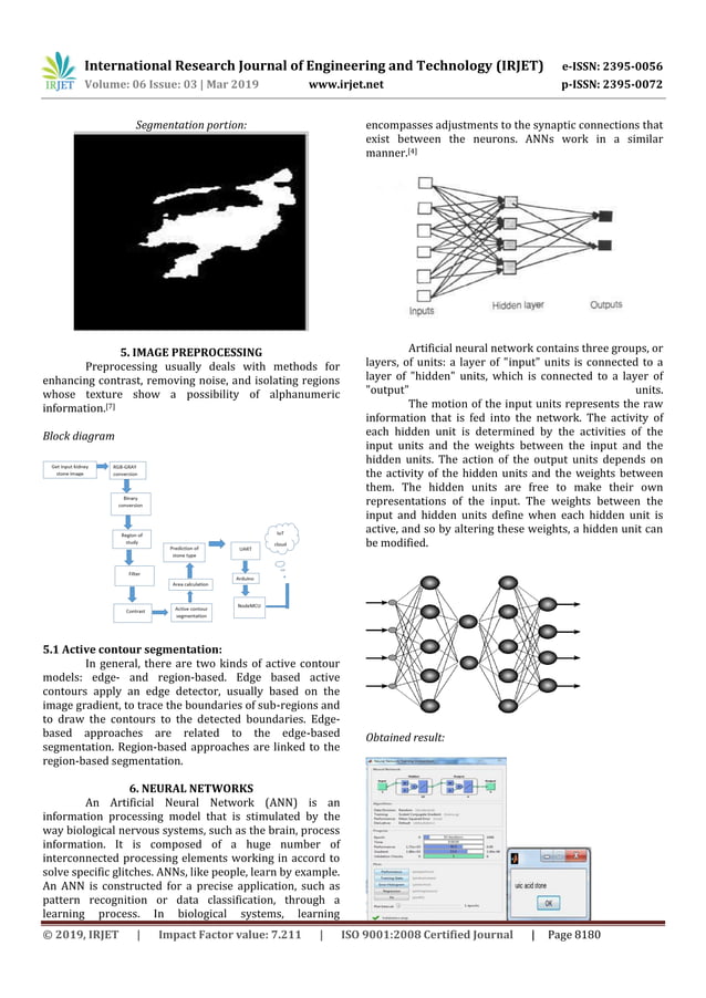 IRJET- Kidney Stone Classification using Deep Neural Networks and Facilitating Diagnosis using ...