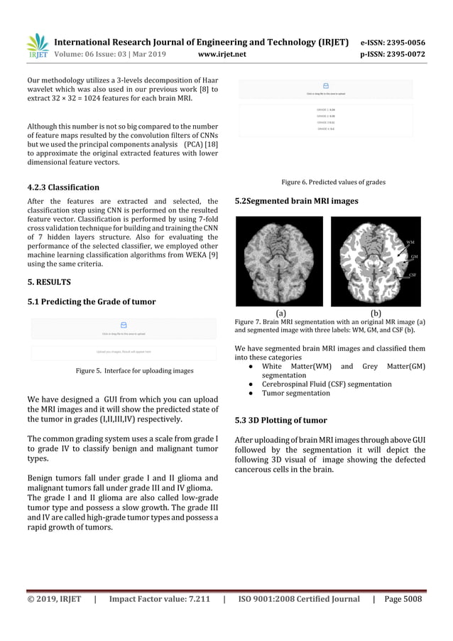 IRJET- Brain MRI Image Processing & Prediction of Cancer Stage Including 3D Plotting ...