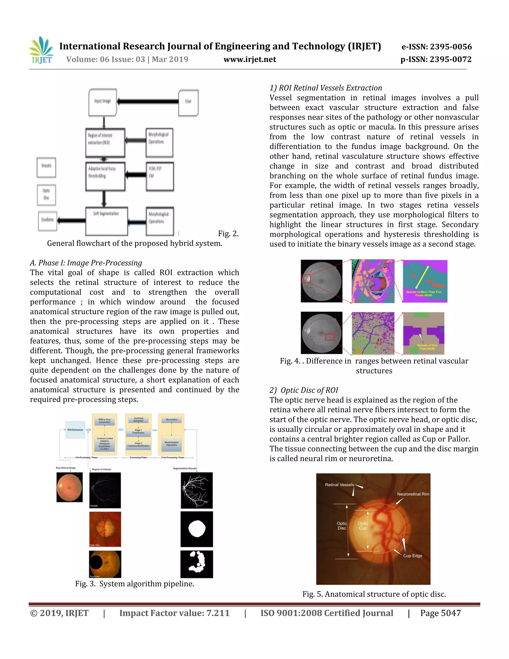 IRJET- Retinal Structure Segmentation using Adaptive Fuzzy Thresholding | PDF