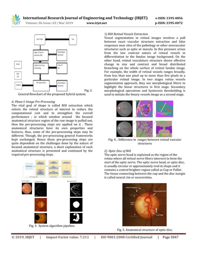 IRJET- Retinal Structure Segmentation using Adaptive Fuzzy Thresholding | PDF
