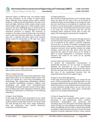 IRJET- Retinal Structure Segmentation using Adaptive Fuzzy Thresholding | PDF