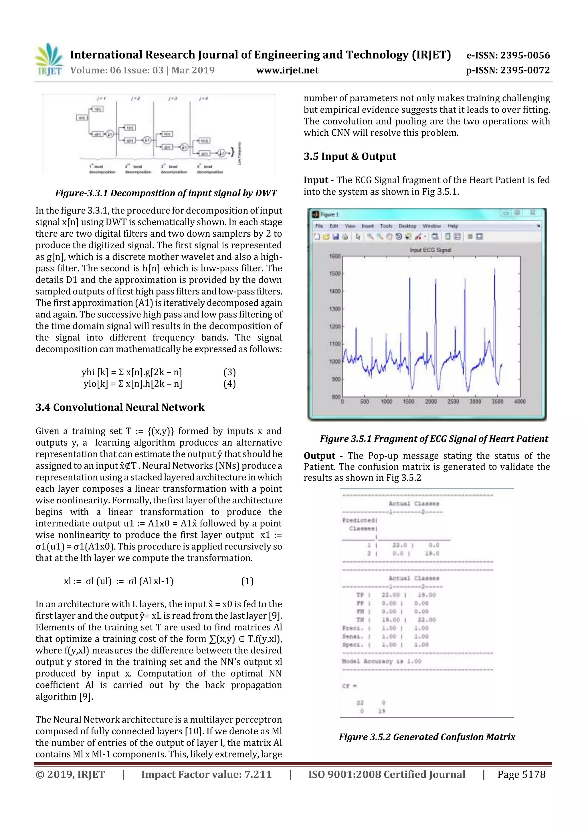Irjet Detection Of Abnormal Ecg Signal Using Dwt Feature Extraction 3329