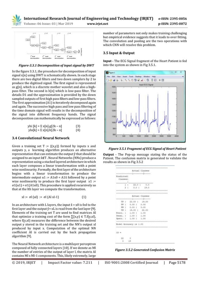 Irjet Detection Of Abnormal Ecg Signal Using Dwt Feature Extraction