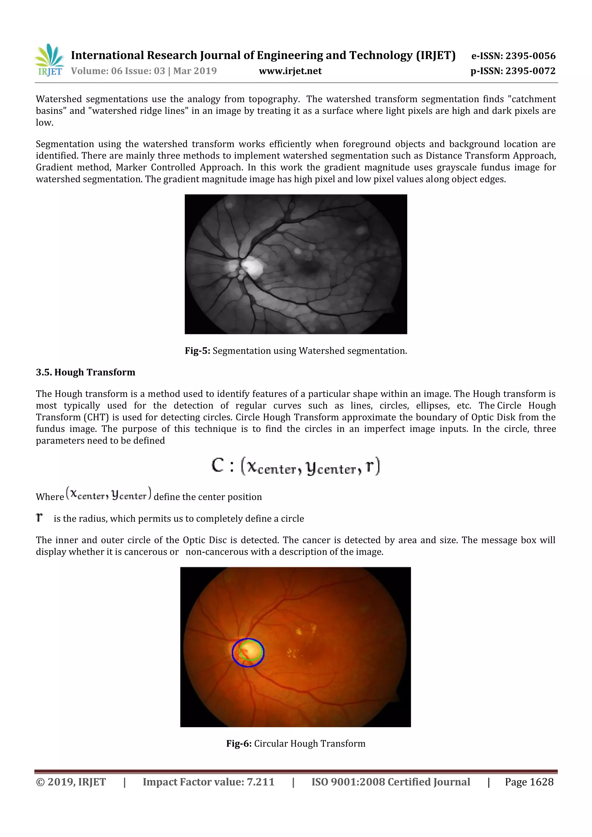 Irjet Retinal Fundus Image Segmentation Using Watershed Algorithm Pdf
