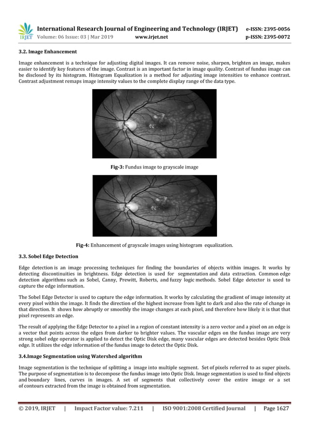 IRJET- Retinal Fundus Image Segmentation using Watershed Algorithm | PDF