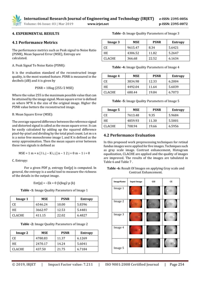 IRJET- Comparison of Preprocessing Methods for Diabetic Retinopathy Detection using Fundus ...