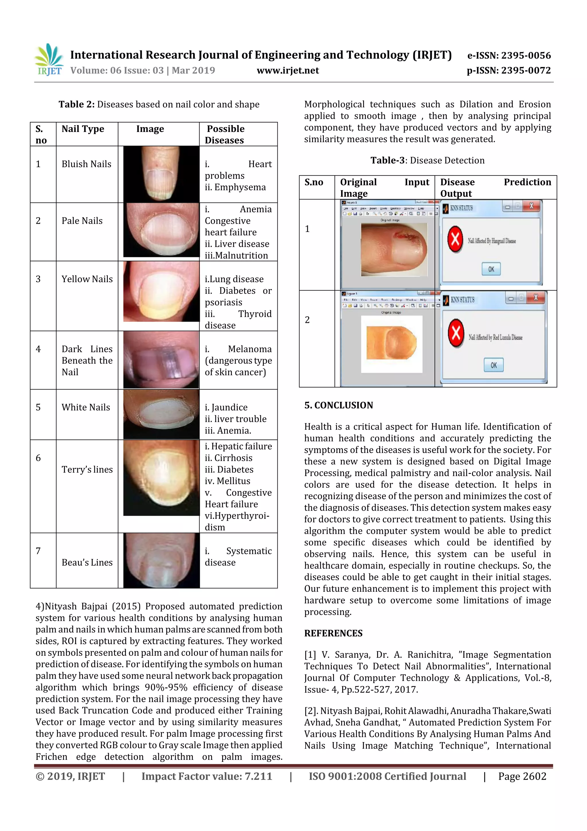 IRJET- Nail based Disease Analysis at Earlier Stage using Median Filter ...