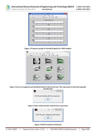 IRJET- Emotion Analysis for Personality Inference from EEG Signals ...