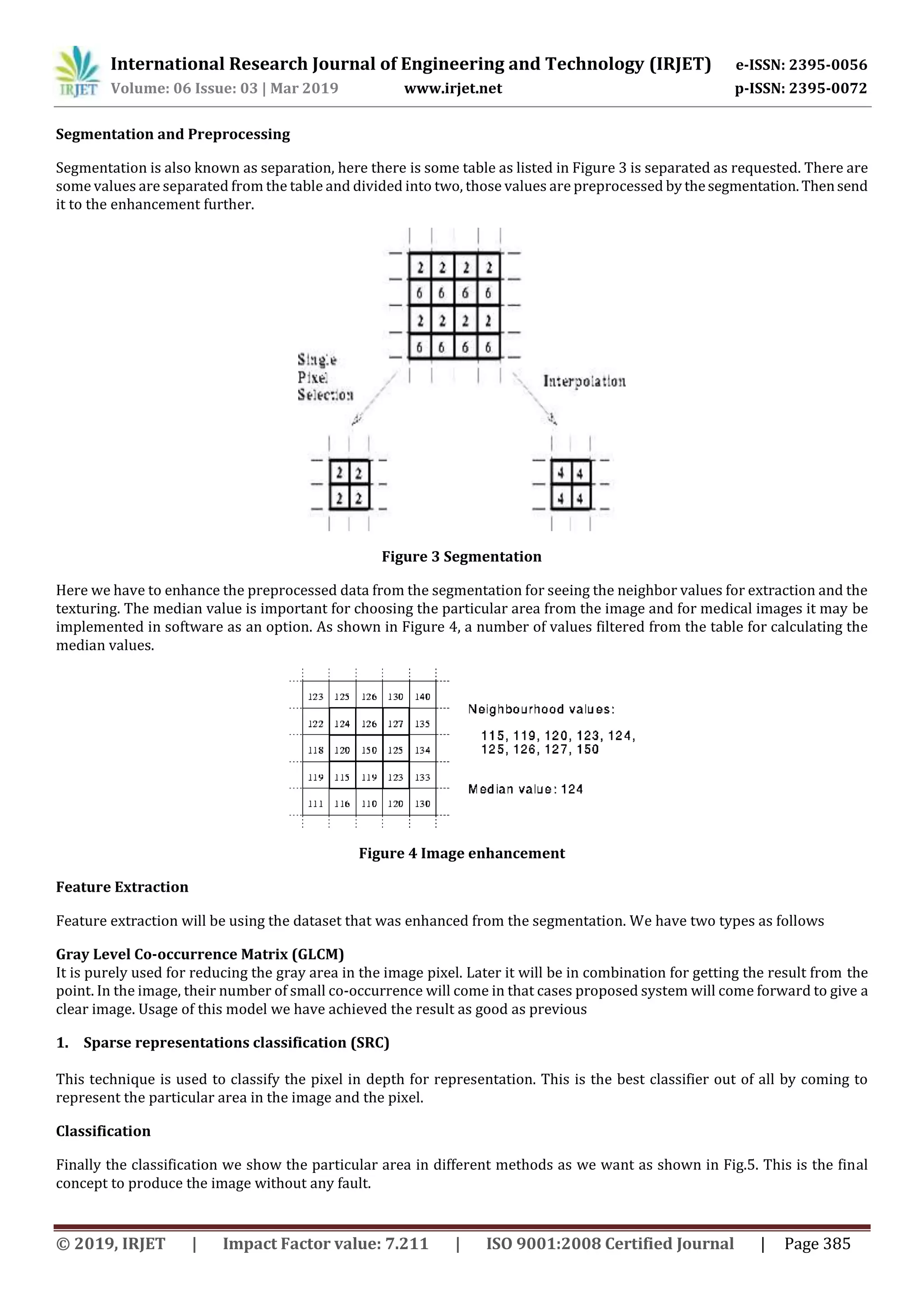 IRJET- Automatic Detection of Diabetic Retinopathy Using SRC Classifier ...