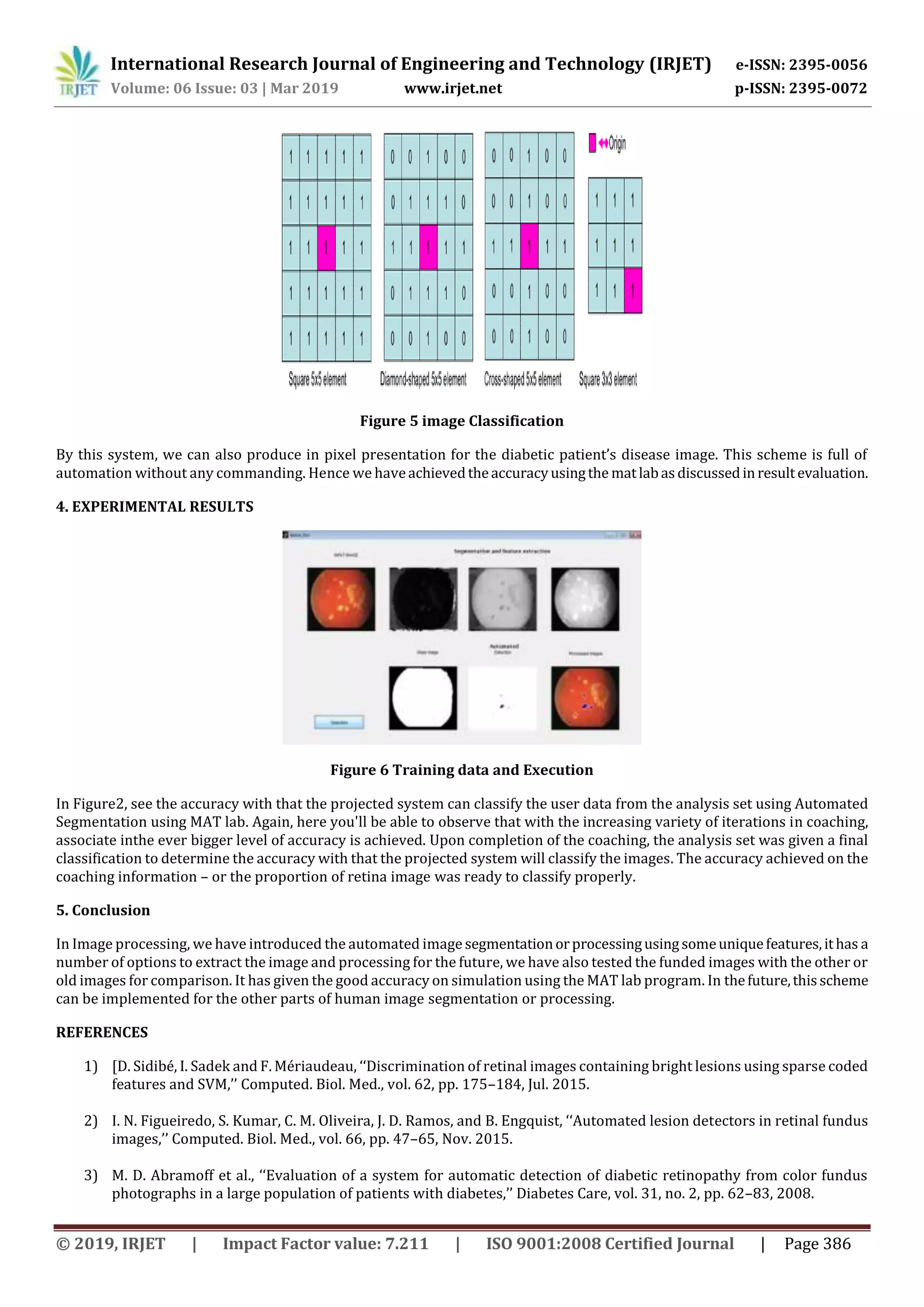 IRJET- Automatic Detection of Diabetic Retinopathy Using SRC Classifier ...