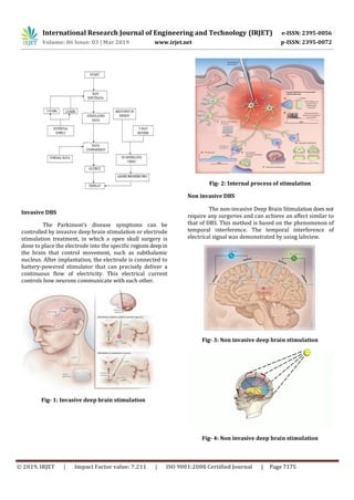 IRJET- Non Invasive Deep Brain Stimulation Via Temporally Interfering Electric Field for ...
