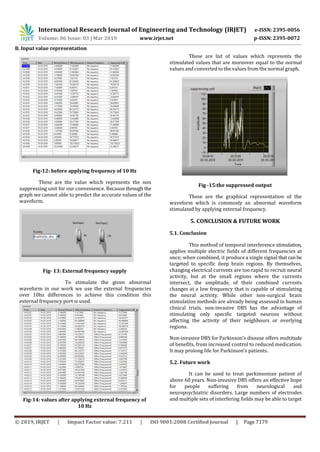 IRJET- Non Invasive Deep Brain Stimulation Via Temporally Interfering Electric Field for ...