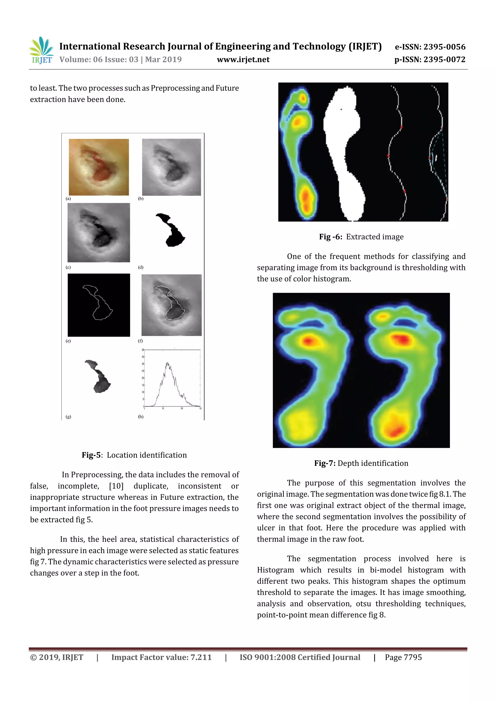 IRJET- Identification and Analysis of Foot Ulceration using Load Cell Technique | PDF