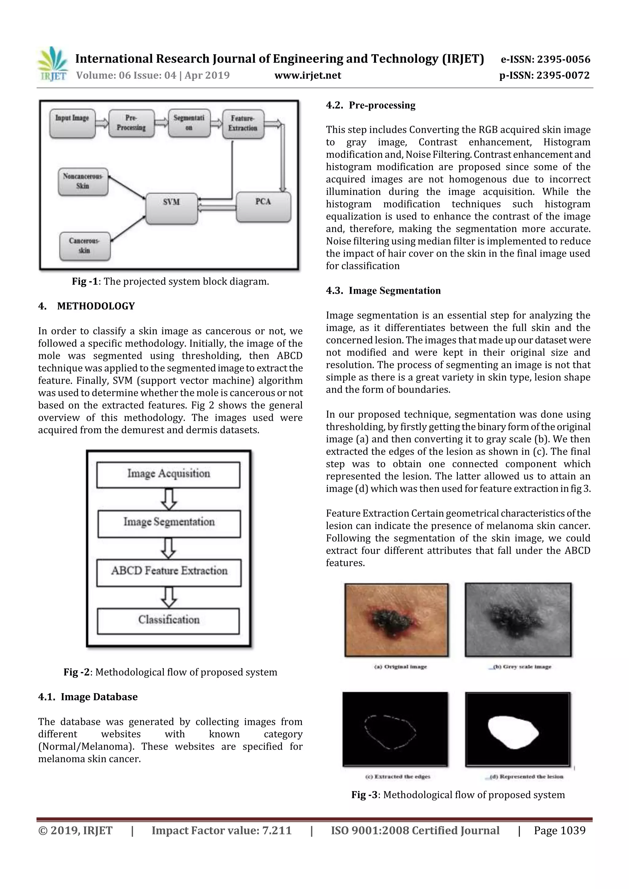 IRJET- Detection & Classification of Melanoma Skin Cancer | PDF