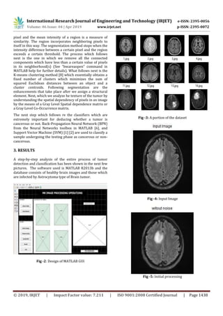 IRJET- MRI Image Processing Operations for Brain Tumor Detection | PDF | Photo Editing Software ...
