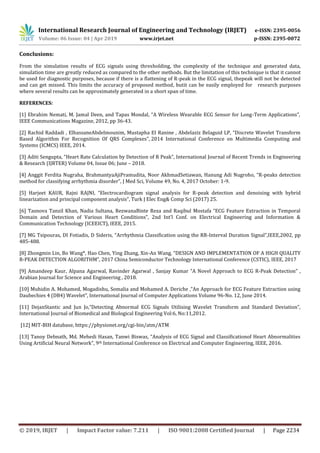 IRJET- R–Peak Detection of ECG Signal using Thresholding Method | PDF