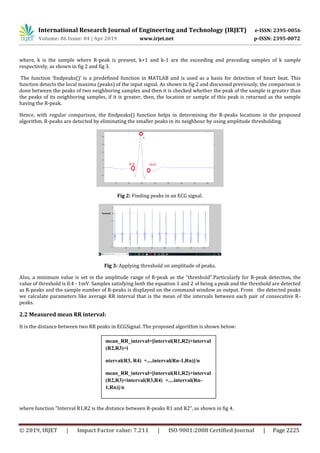 IRJET- R–Peak Detection of ECG Signal using Thresholding Method | PDF
