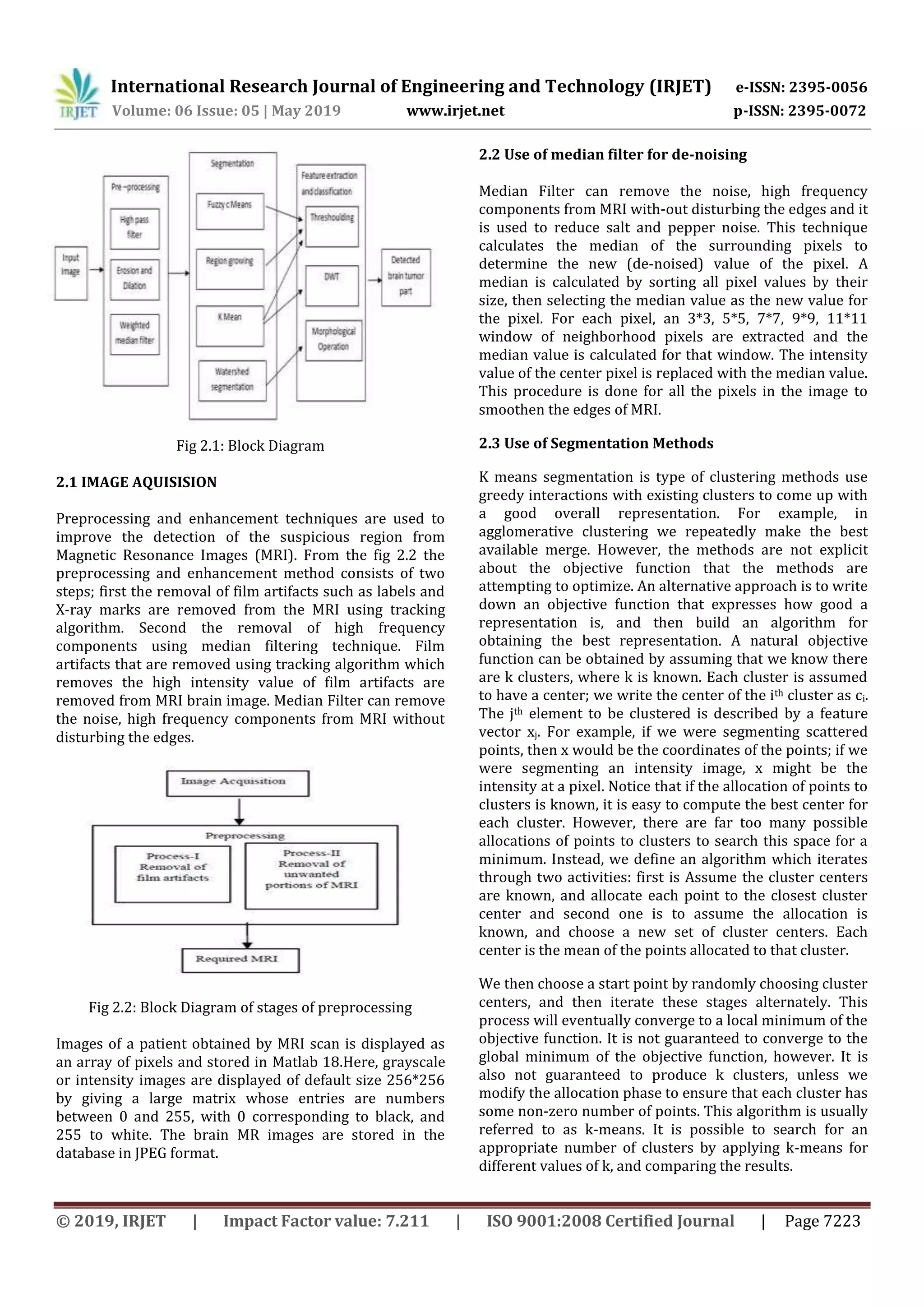 Irjet Brain Tumor Detection Using Digital Image Processing Pdf