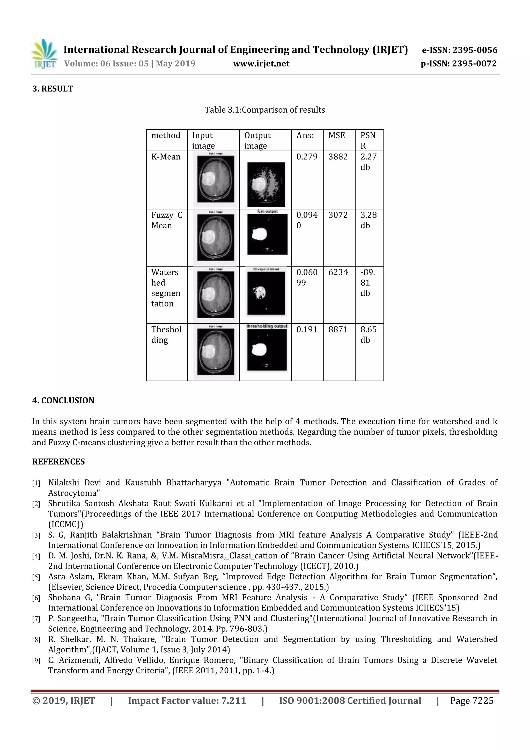 Irjet Brain Tumor Detection Using Digital Image Processing Pdf