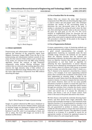 IRJET- Brain Tumor Detection using Digital Image Processing | PDF | Photo Editing Software ...