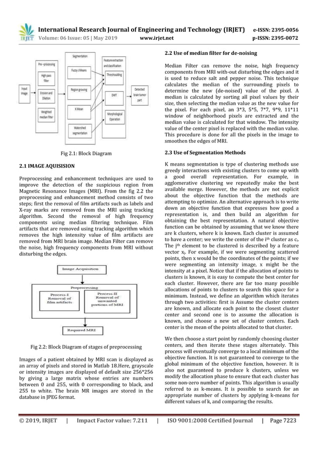 IRJET- Brain Tumor Detection using Digital Image Processing | PDF ...