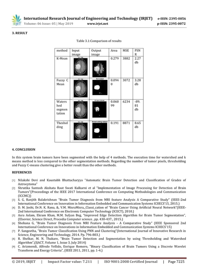 IRJET- Brain Tumor Detection using Digital Image Processing | PDF | Photo Editing Software ...