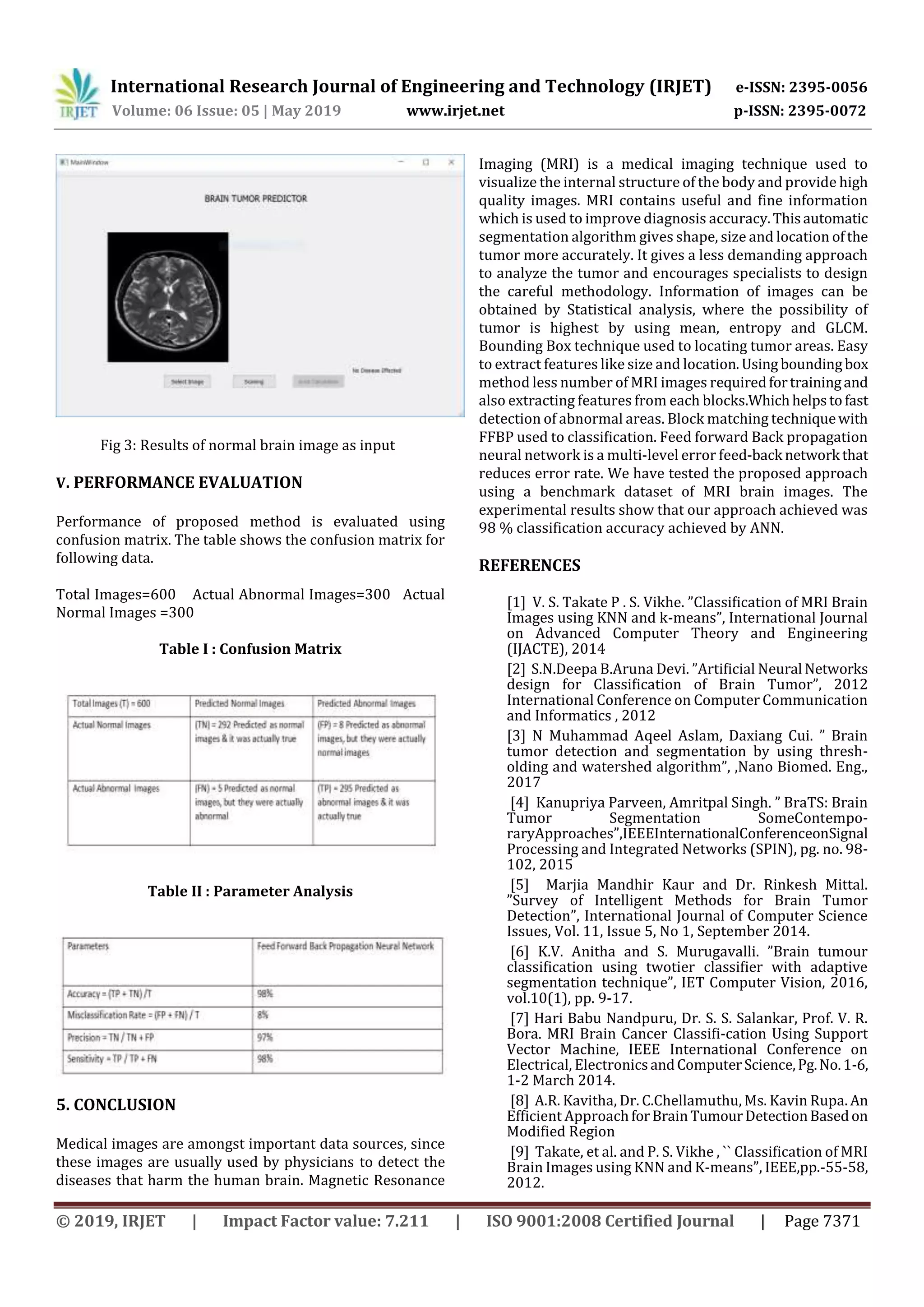 IRJET- Brain Tumor Detection and Classification with Feed Forward Back ...
