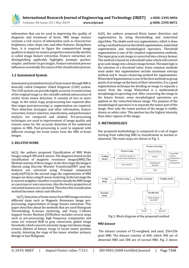 IRJET- Brain Tumor Detection and Classification with Feed Forward Back Propagation Network | PDF