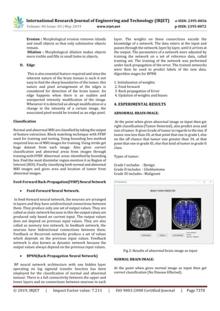 IRJET- Brain Tumor Detection and Classification with Feed Forward Back Propagation Network | PDF
