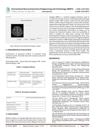 IRJET- Brain Tumor Detection and Classification with Feed Forward Back Propagation Network | PDF